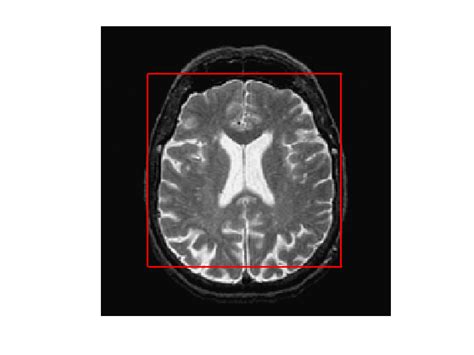 The Geodesic Active Contour Minimizes A Weighted Length Of Curve [ Umin{ Ga} Int 0 1 Norm