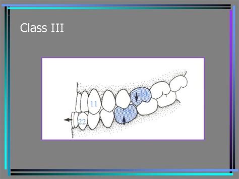 Occlusion Chapter Definition Occlusion Is Defined As