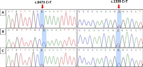 Representative Electropherogram Of Compound Heterozygote Variants In