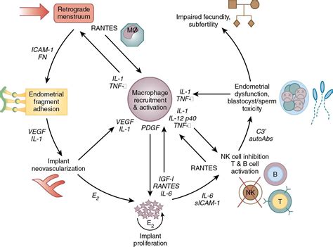 Endometriosis Etiology Pathology Diagnosis Management Clinical Tree