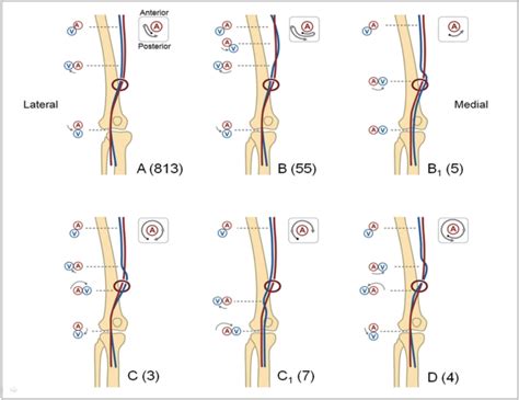 Schematic Drawings Of Different Types Of Three Dimensional Positional Download Scientific