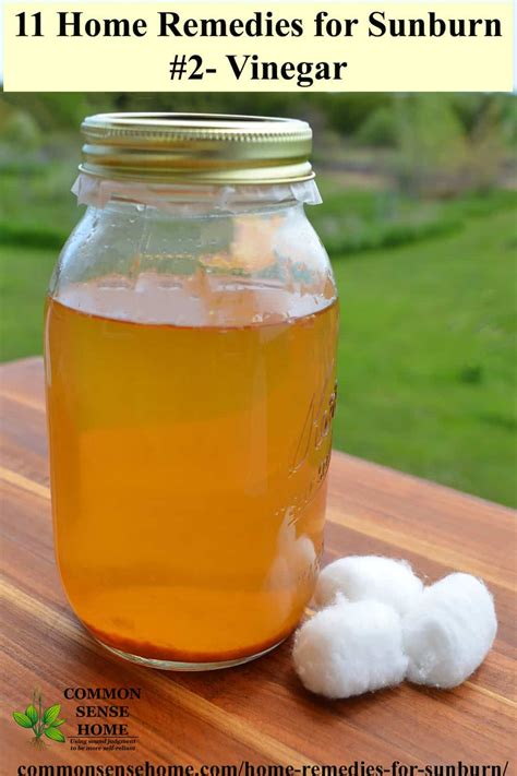 11 Home Remedies For Sunburn Relief To Get Rid Of Sunburn