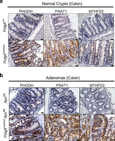Mitochondrial Oxphos Dysfunction Causes Upregulation Of De Novo Serine