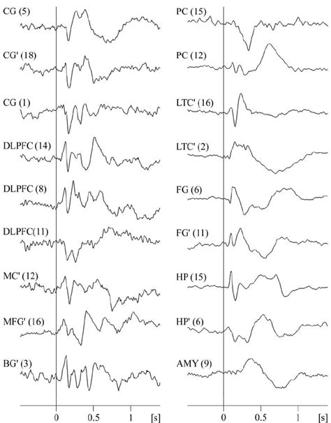 Examples Of Event Related Potentials Induced By Non Target Visual Download Scientific Diagram