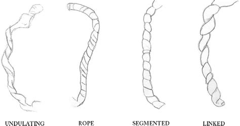 Umbilical Cord Coiling Index Obstetrical Pathology