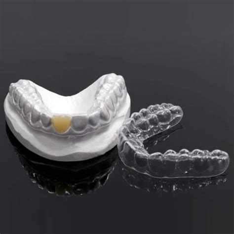 Clear Essix Pontic Retainer