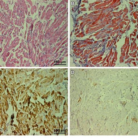 Hematoxylin And Eosin He Staining A And Massons Trichrome Staining