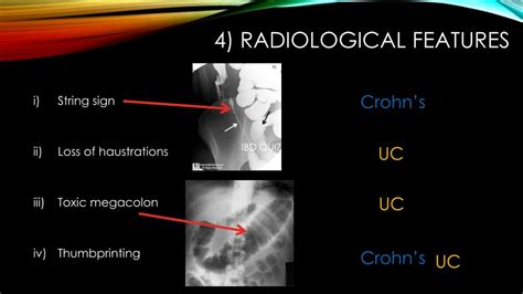 Ppt Ibd Quiz Powerpoint Presentation Free Download Id 2141096
