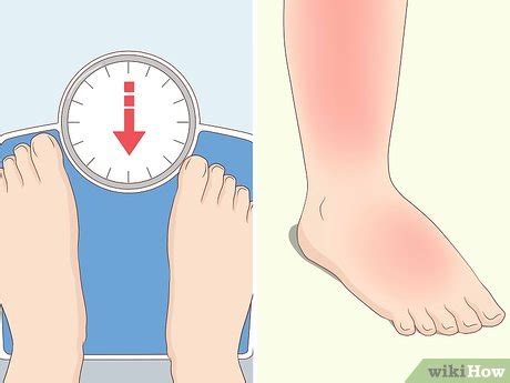 How To Prevent C Diff Infections