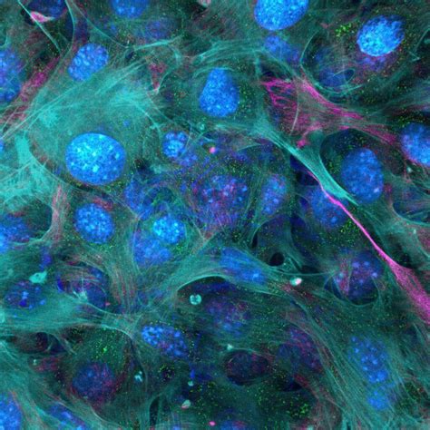 Biotium On Linkedin Fluorescencefriday Microscopy Confocal Lablife