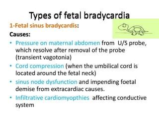 Fetal Arrhythmia Pptx Pregnancy Reproductive Health