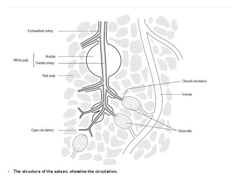 Pre And Post Operative Management Of Paediatric Splenectomy Patients Ppt
