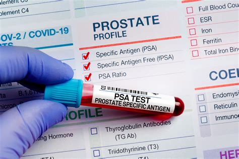 Psa Prostate Cancer Test