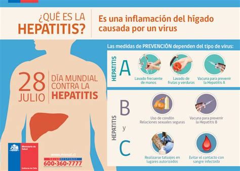 Los Síntomas Típicos De La Hepatitis Son Ictericia Orina Oscura Fatiga