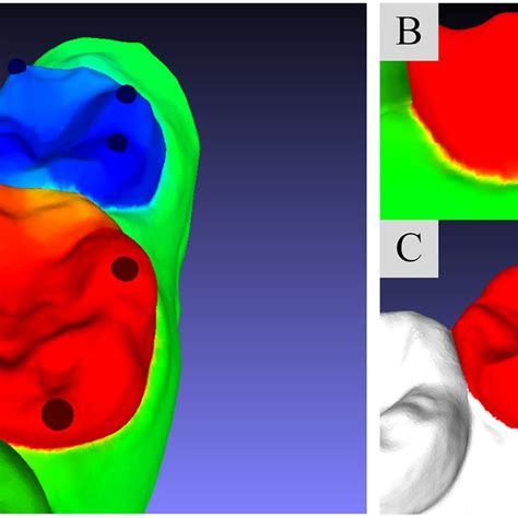 Pdf Interactive Tooth Separation From Dental Model Using Segmentation Field