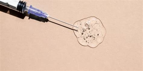 What You Should Know About Combining Dermal Fillers With Neurotoxins
