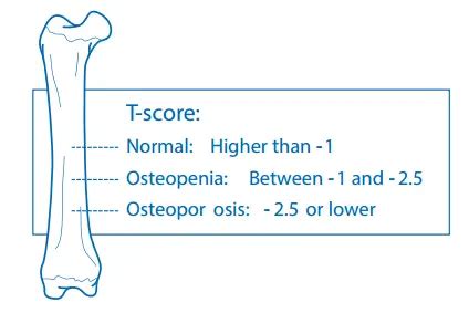 DEXA Bone Mineral Density Test Bone Density Body DEXA Fit
