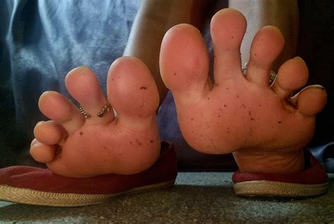 The Jammyest Toes In The Uk R Toejamfeet