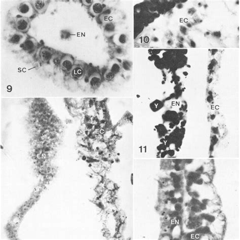 Structural Details Of The Stolon And Of Free Living Polyps 9 Cross