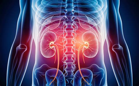 “understanding End Stage Renal Disease Causes Symptoms And Treatment”