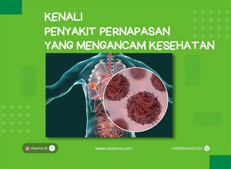 5 Penyakit Pernapasan Berbahaya Kenali Penyebabnya
