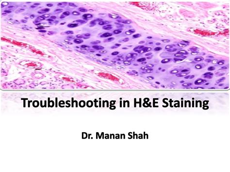 Troubleshooting In Hande Staining Pptx