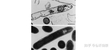 肠道核心菌属毛螺菌属Lachnospira 知乎