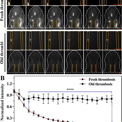 Nir Ii Fluorescence Imaging For Thrombolysis Of The Right Carotid