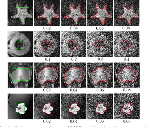 Figure 6 From An Active Contour Model Based On Local Pre Piecewise Fitting Bias Corrections For