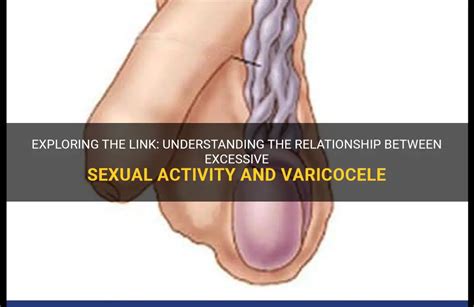 Exploring The Link Understanding The Relationship Between Excessive Sexual Activity And