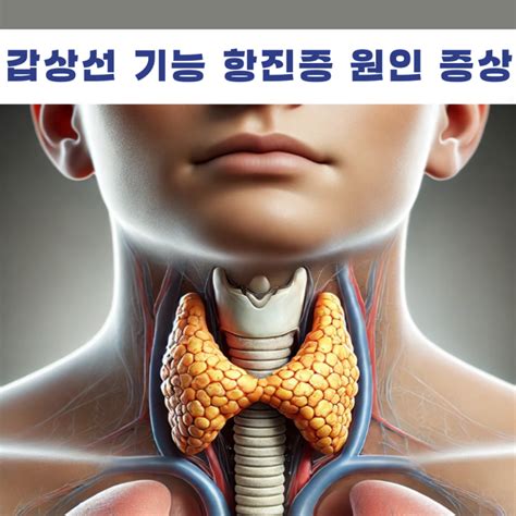 갑상선기능항진증 원인 증상 안구돌출 체중 심장 생리 설사 탈모 네이버 블로그