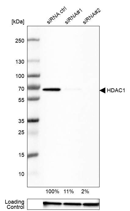 Rabbit Polyclonal Anti Hdac1 Antibody Buy For Research Highly