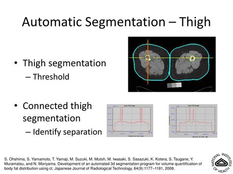 Ppt Automated Segmentation Of Computed Tomography Images Powerpoint Presentation Id 4356888