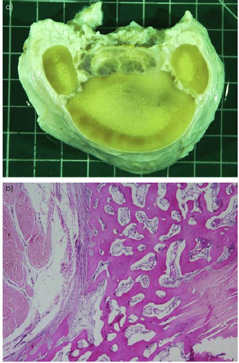 A Gross Post Mortem Image Of Transverse Section Through Mciii The Download Scientific Diagram