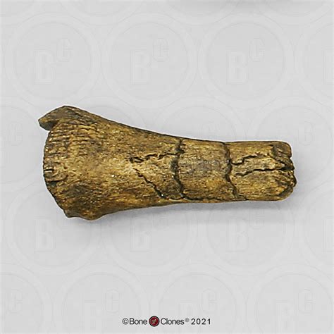 Australopithecus Anamensis Right Distal Tibia Knm Kp 29285b Bone Clones Osteological