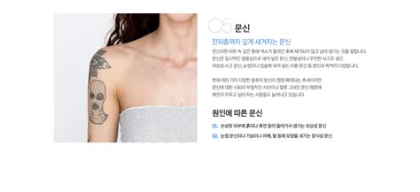 퍼스널 단점제거핀홀 피코 문신 제거 서울나인앤의원