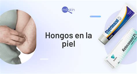 Tipos De Hongos En Texas Diferentes Tipos De Hongos — Foto De Stock