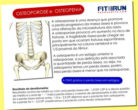Luciana MagalhÃes Personal Trainer Osteoporose E Osteopenia