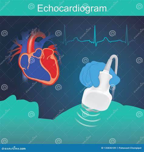 Echocardiogram Health Care Info Graphic Cartoon Vector CartoonDealer Com 135836109