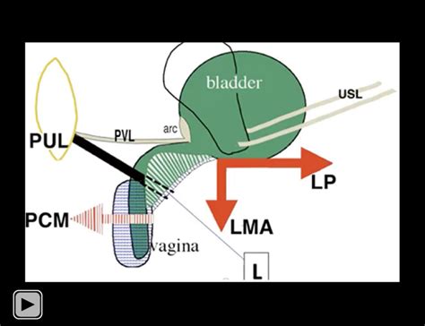 A Brief Physiology And Pathophysiology Of The Bladder Pmc