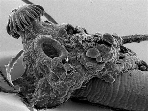 Biología De Echinococcus Granulosus Asociación De Hidatidología