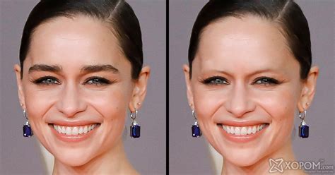 Хөмсөг хүний гадаад төрхөнд асар их нөлөө үзүүлдгийг батлах 15 алдартны зураг