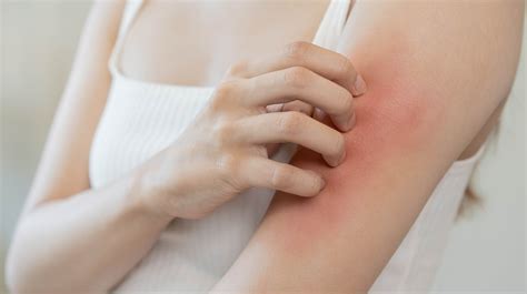Whats The Difference Between Eczema And Psoriasis