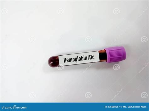 Hemoglobin A1c Hba1c Diabetic Treatment Monitoring Test Stock Image Image Of Sample