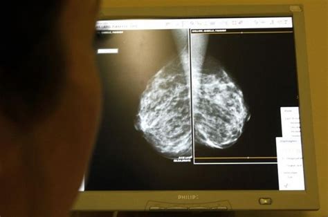 Most Women Who Have Double Mastectomies Do Not Need Them