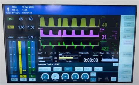 Un Moniteur Avec Un écran De Contrôle De La Pression Dessus Photo Premium
