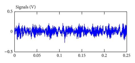 Vibration Signal Waveforms Of Different Conditions Download
