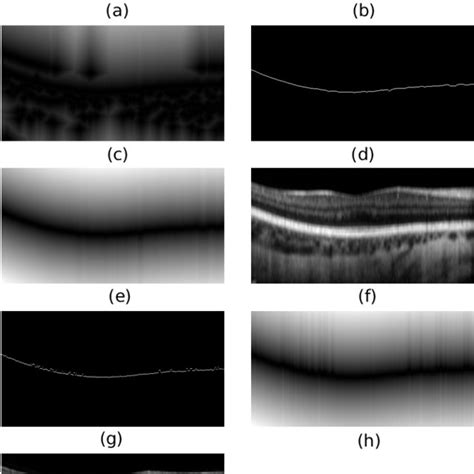 Sample Oct Image With Choroidal Layer Boundaries Marked In Red Download Scientific Diagram
