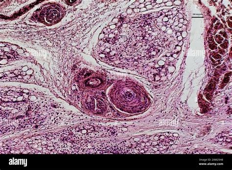 Micrograph Of Pacinian Corpuscle Vertical Section At 10 Times