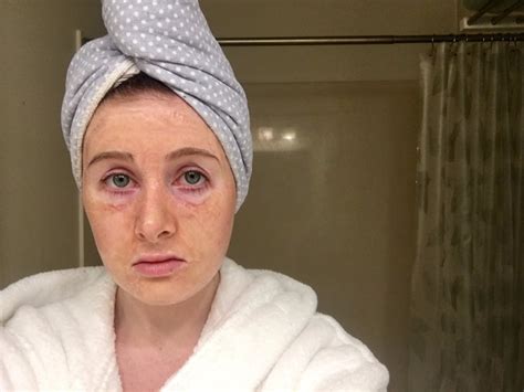 Hanacure Mask Review Ps Beauty